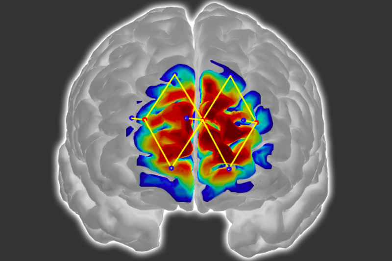 fNIR spectroscopy can detect pain levels | Spectroscopy Europe/World