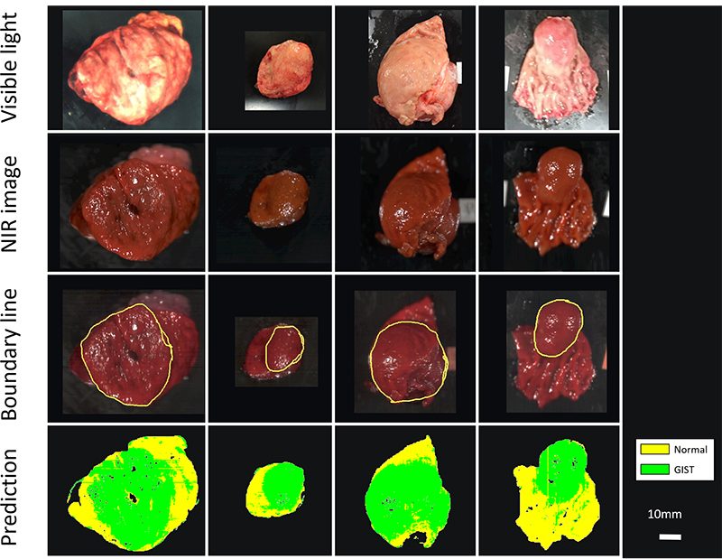 NIR-HSI can identify hidden gastrointestinal tumours | Spectroscopy ...