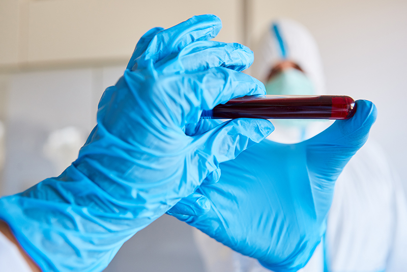 A practical guide to sample preparation for liquid chromatography ...