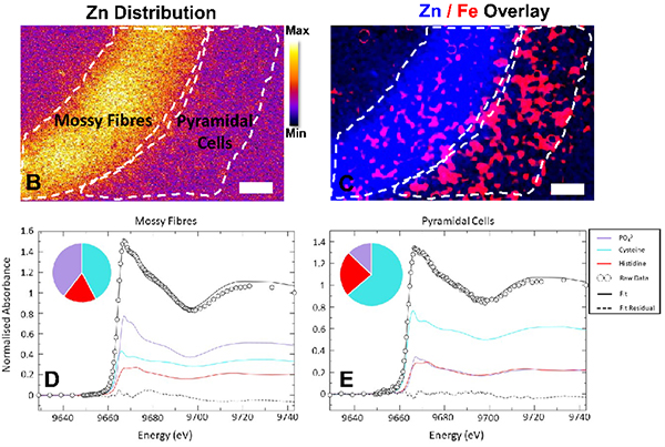 Mapping metals in brain tissue with X-ray fluorescence and X-ray ...