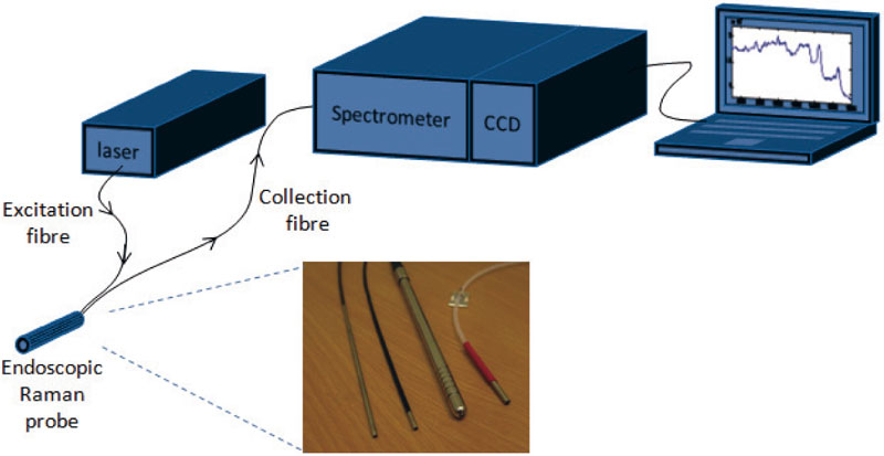 Development of fibre-optic Raman probes for in vivo diagnosis of upper ...