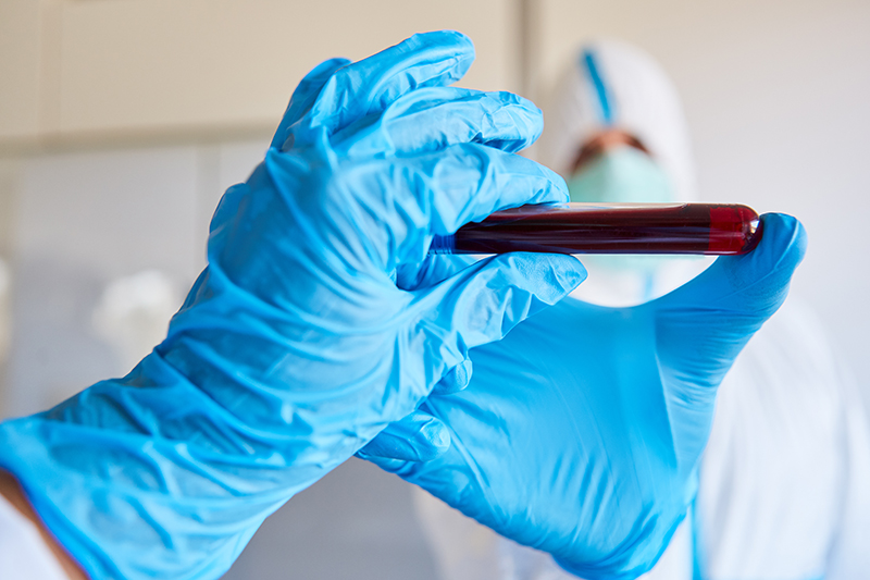 NMR metabolomics to detect cancer and its spread | Spectroscopy Europe ...